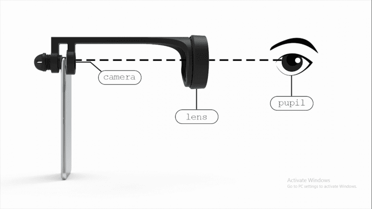 Mobile Fundoscopy | smartphone fundoscopy | smartphone fundoscopy